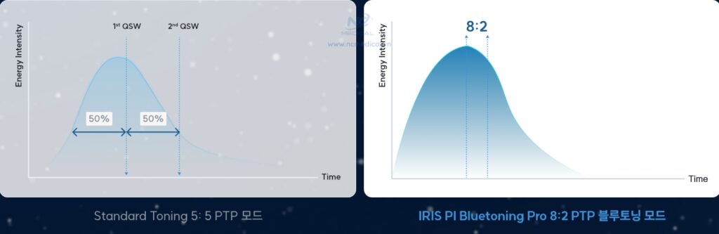 IRIS PI - NC Medical